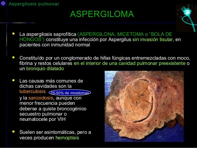 Aspergilosis