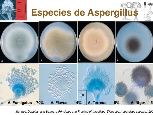 Aspergilosis