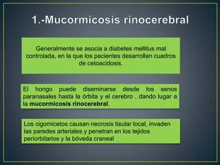 Aspergilosis y cigomicosis | PPTX
