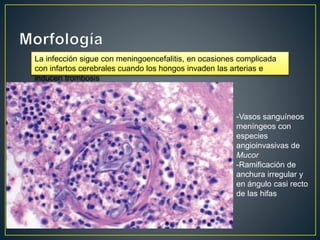 Aspergilosis y cigomicosis | PPTX