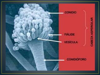 Aspergilosis y cigomicosis | PPTX