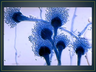 Aspergilosis y cigomicosis | PPTX