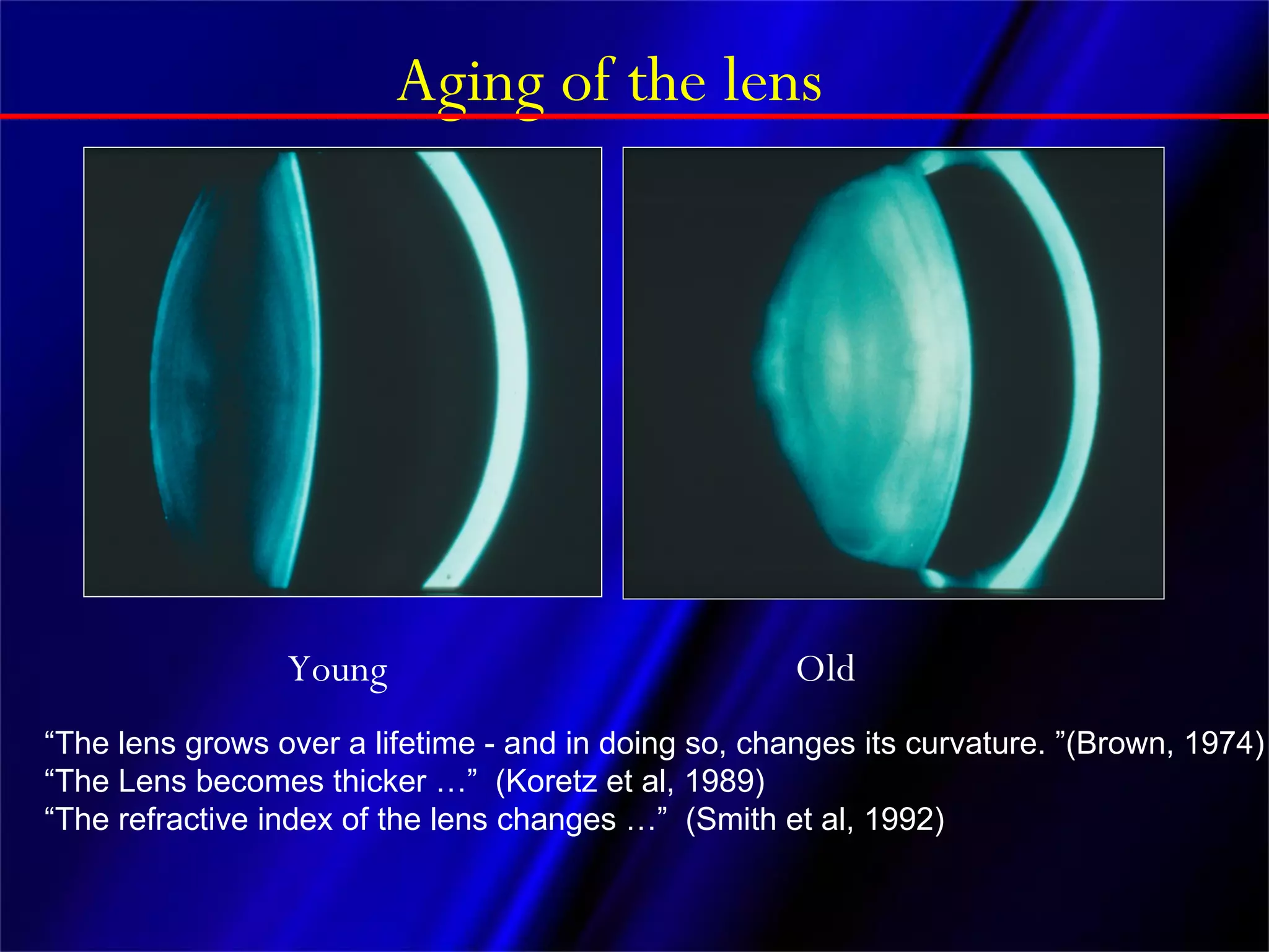 Aspheric IOLs for CRGH | PPT