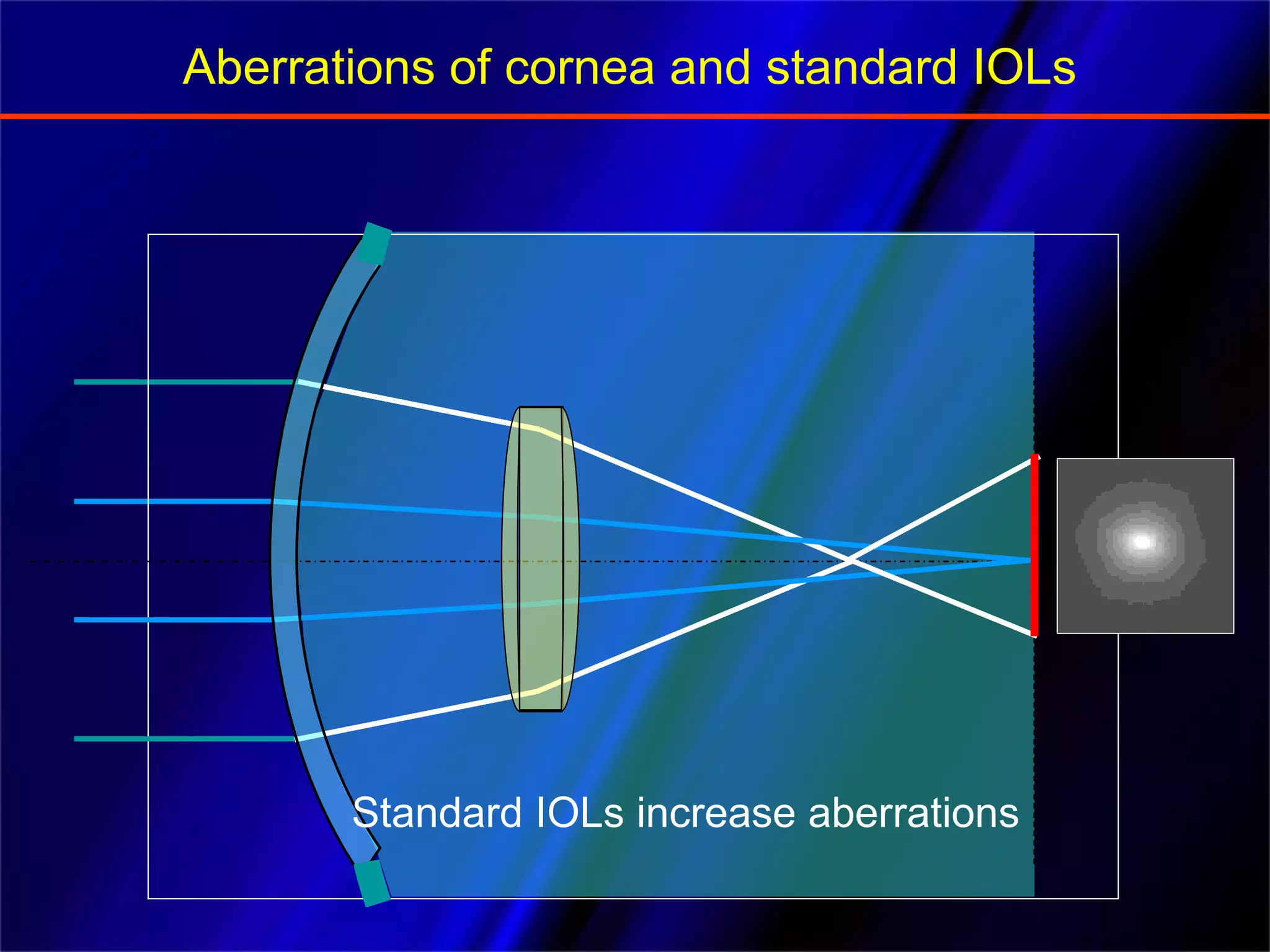 Aspheric IOLs for CRGH | PPT