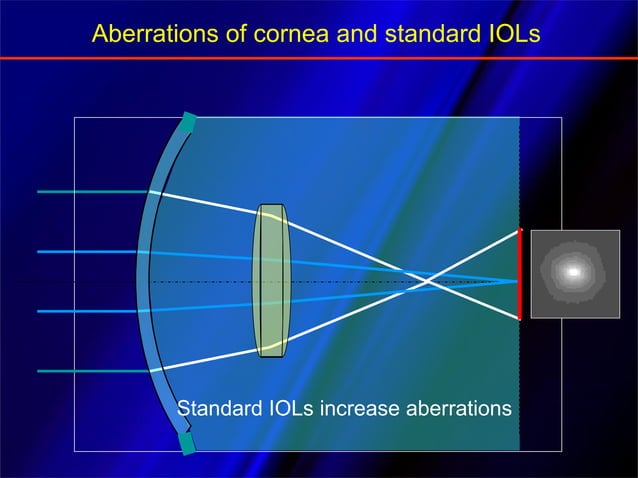 Aspheric IOLs for CRGH | PPT | Eye and Vision Conditions | Diseases and ...