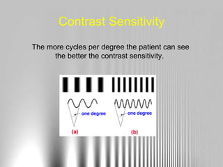 Aspheric IOLs for CRGH | PPT