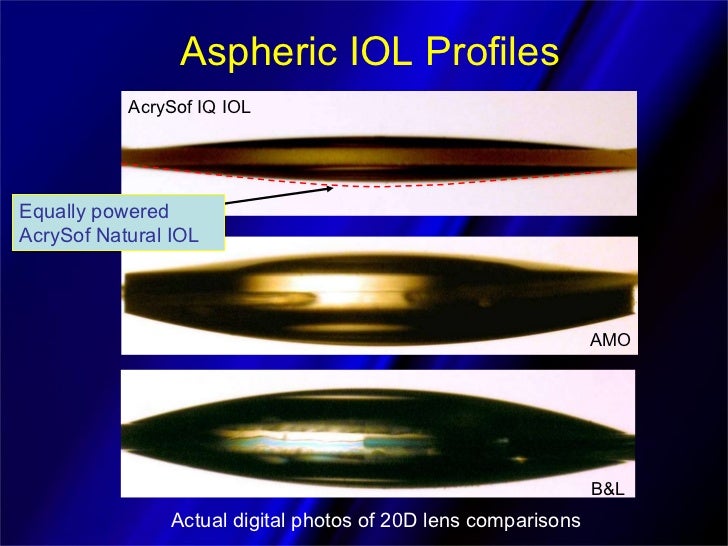 Aspheric IOLs for CRGH
