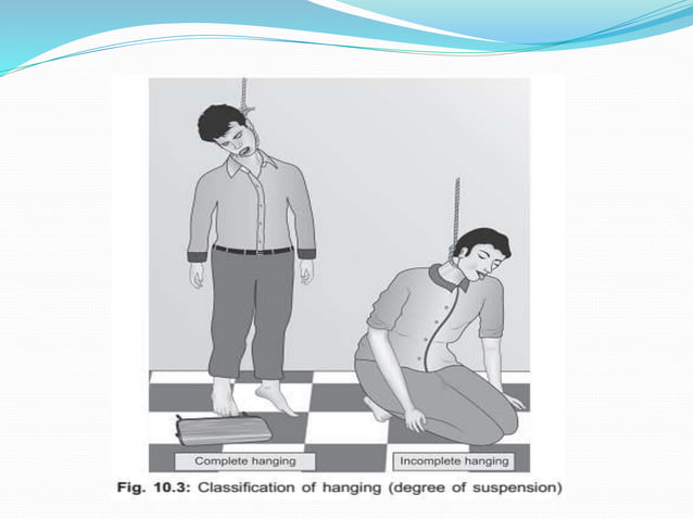 Asphyxia | PPTX | First Aid | Injuries