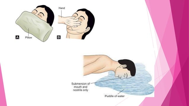 asphyxia.pdf