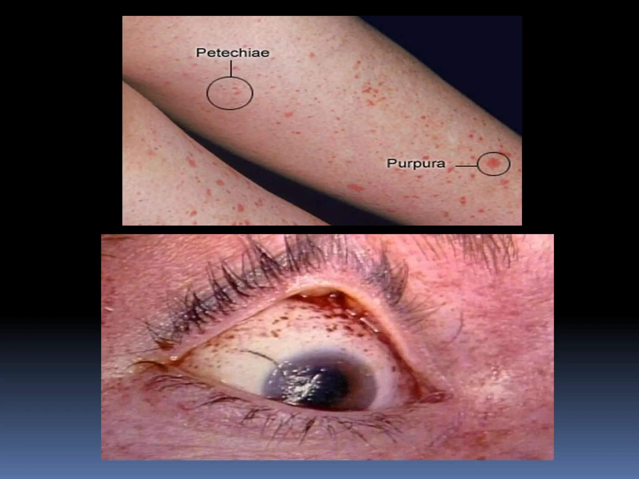 Asphyxia death .pptx useful class ppt in all | PPTX