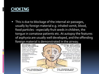 Asphyxia death .pptx useful class ppt in all | PPTX