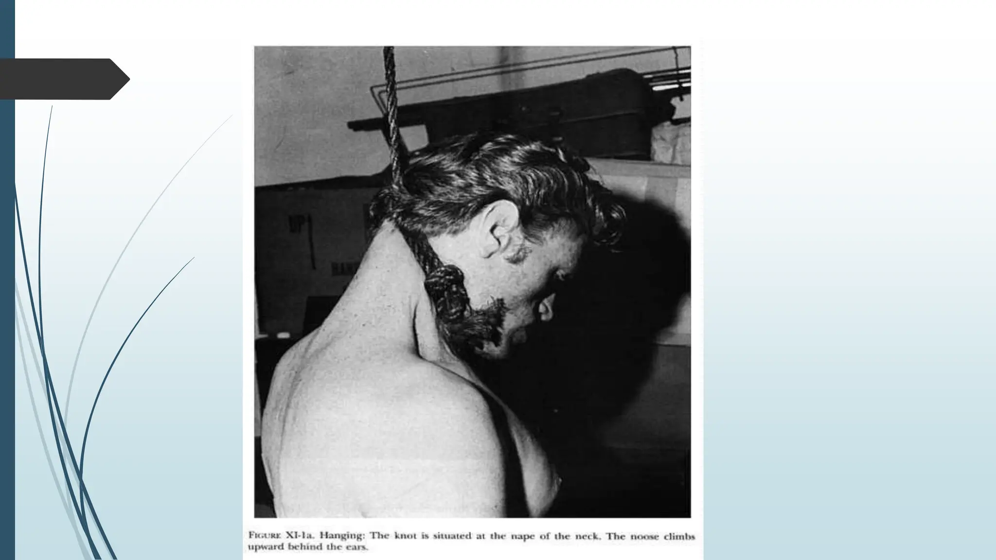 All about asphyxia in forensic medicine.1.pptx