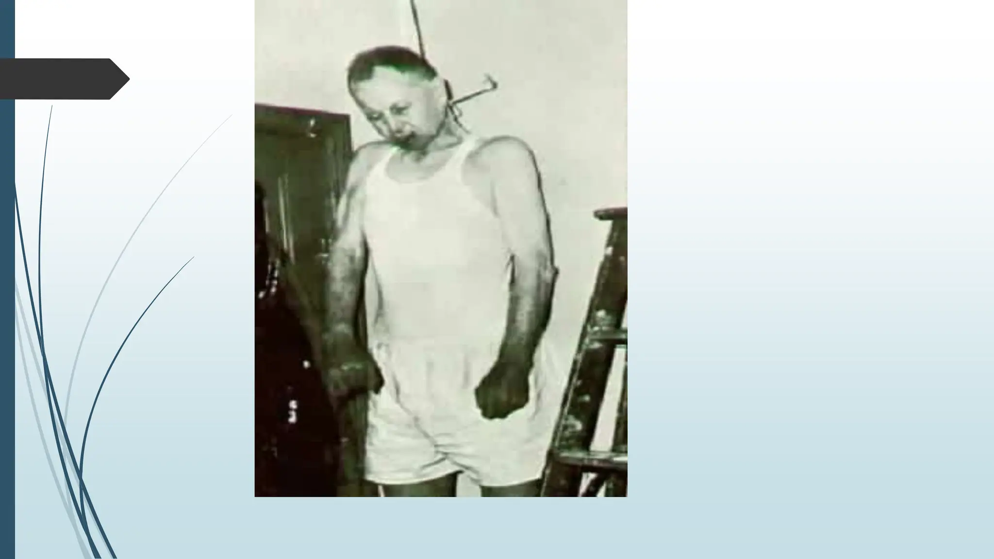 All about asphyxia in forensic medicine.1.pptx