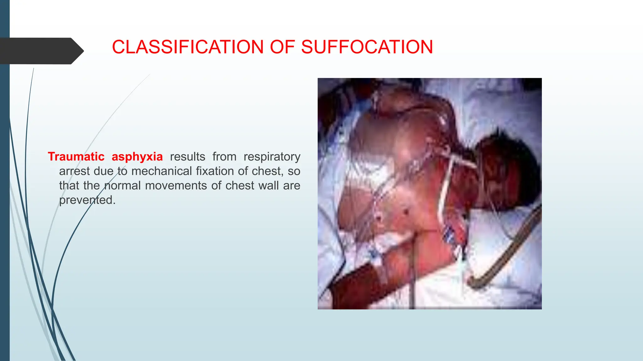 All about asphyxia in forensic medicine.1.pptx