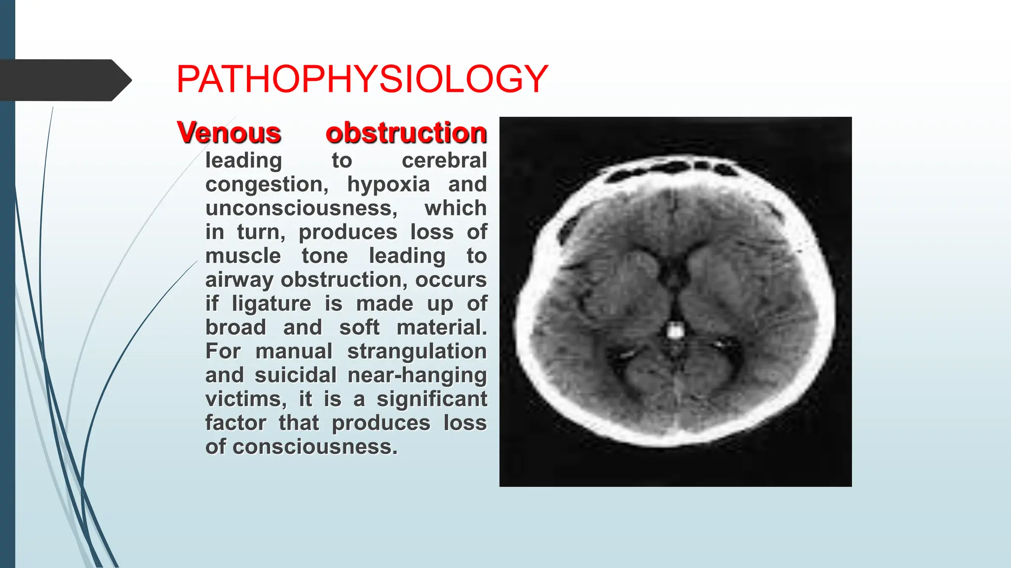 All about asphyxia in forensic medicine.1.pptx