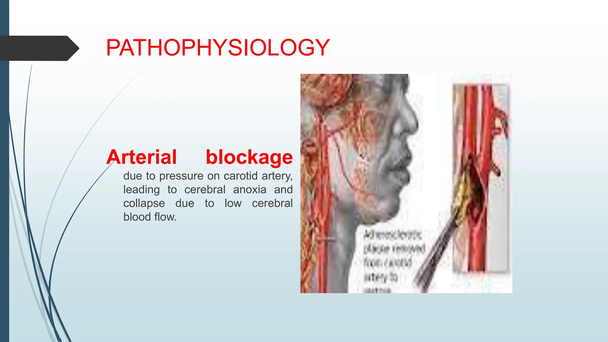 All about asphyxia in forensic medicine.1.pptx