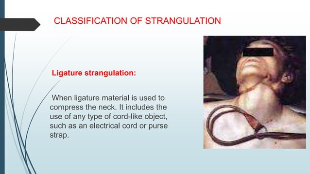 All about asphyxia in forensic medicine.1.pptx | First Aid | Injuries