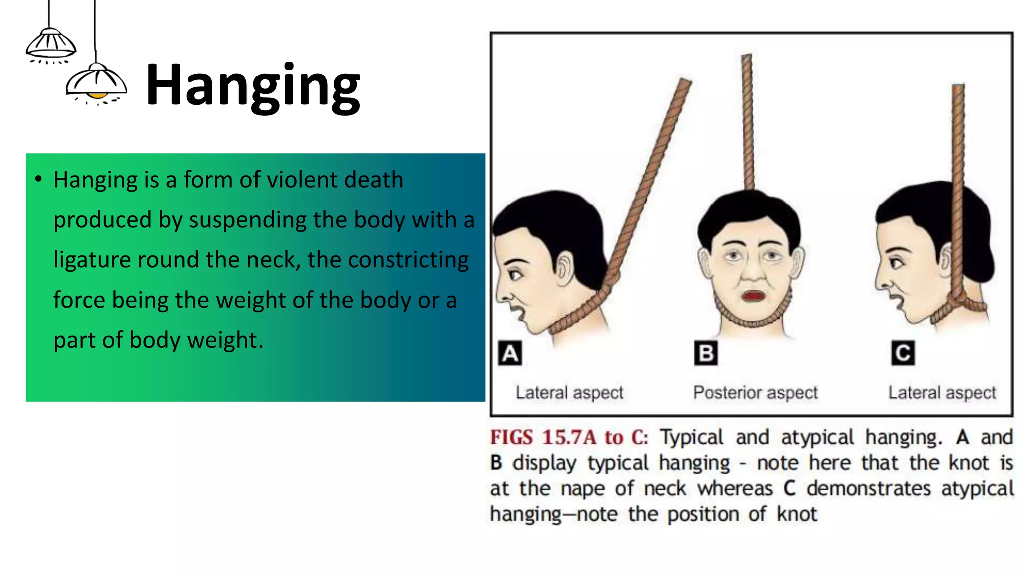 Asphyxial deaths | PPTX