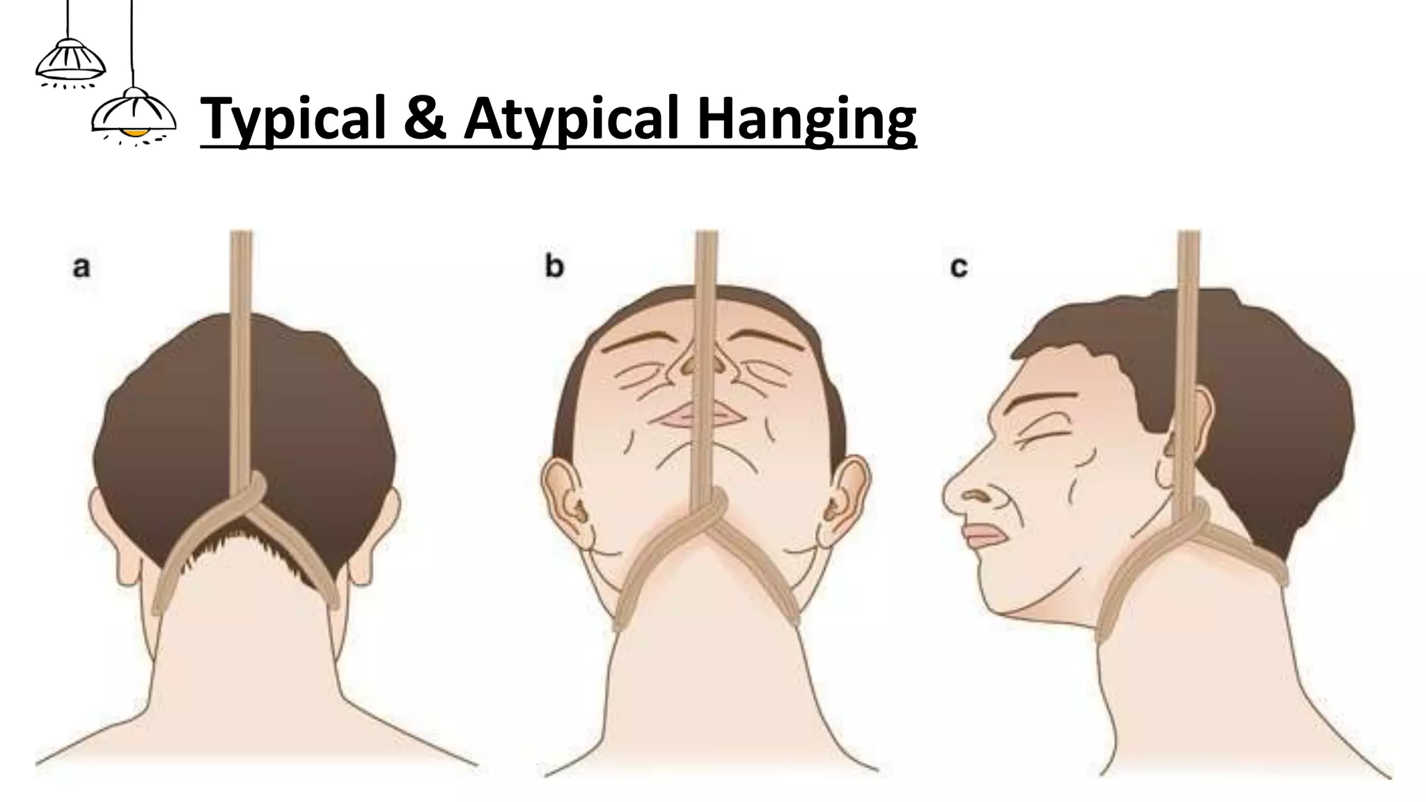 Asphyxial deaths | PPTX