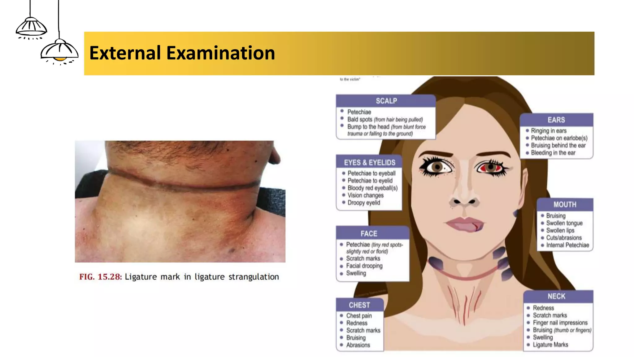 Asphyxial deaths | PPTX