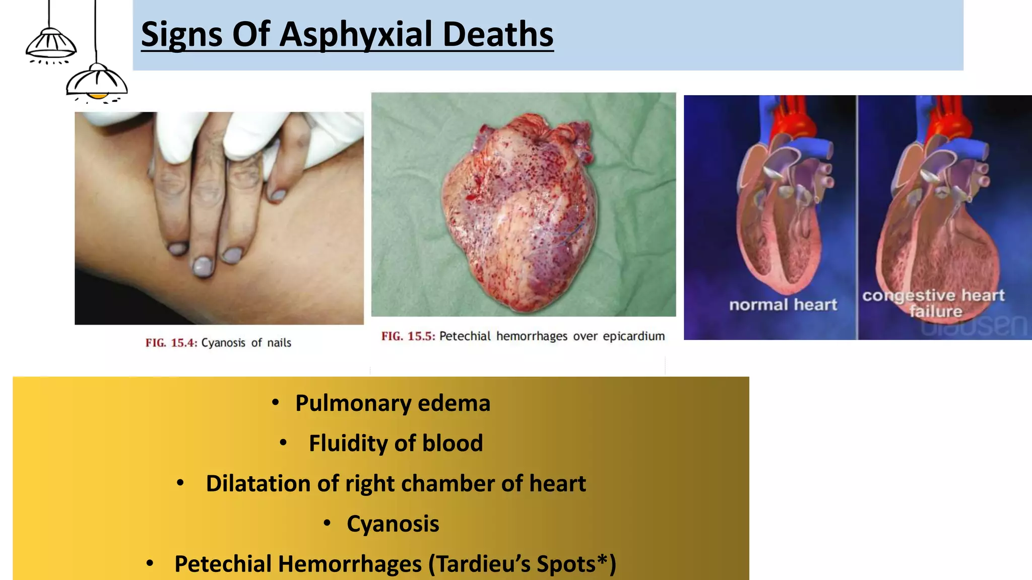 Asphyxial deaths | PPTX