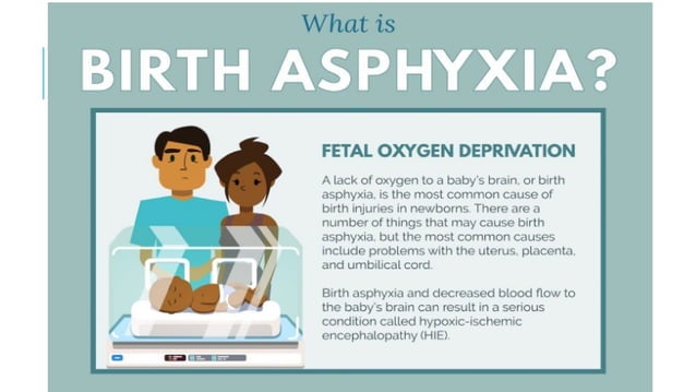 Comprehensive Understanding of Asphyxia Neonatorum: Causes, Diagnosis ...