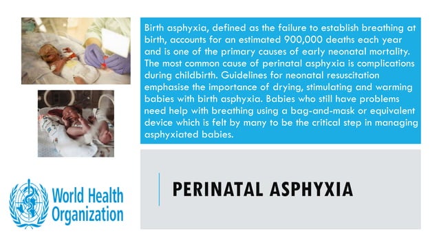 Comprehensive Understanding of Asphyxia Neonatorum: Causes, Diagnosis ...