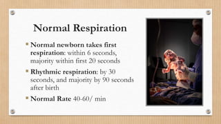 ASPHYXIA NEONATORUM.pptx