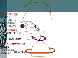 Asphyxia and airway death | PPT