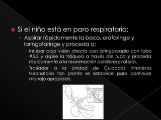 Aspiracion del Meconio | PPSX