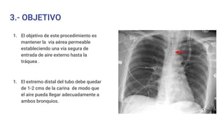 ASPIRACION DE SECRECIONES A TRAVEZ DE TUBO ENDOT..pptx