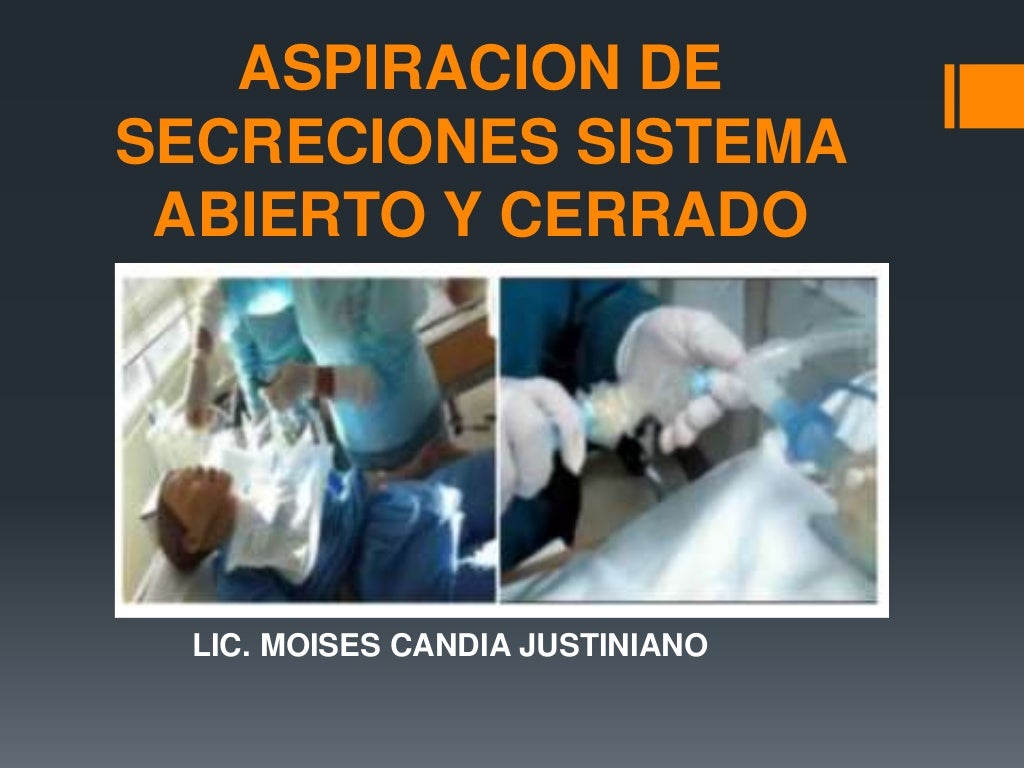 Aspiracion de secreciones sistema abierto y cerrado Aspiracion de secreciones sistema abierto y cerrado