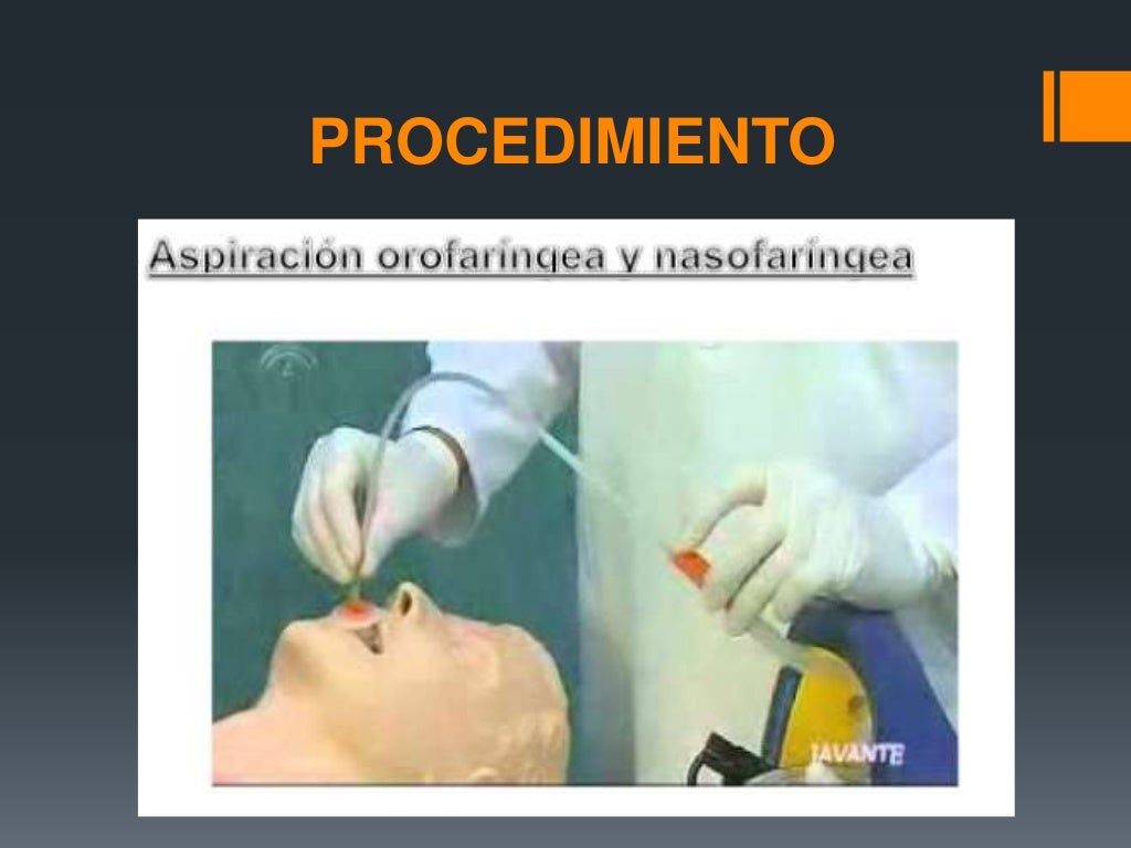 Aspiracion de secreciones sistema abierto y cerrado Aspiracion de secreciones sistema abierto y cerrado
