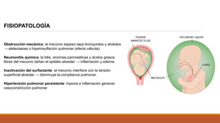 Aspiracion por meconio en pacientes pediatricos | PPTX