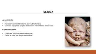 Aspiracion por meconio en pacientes pediatricos | PPTX