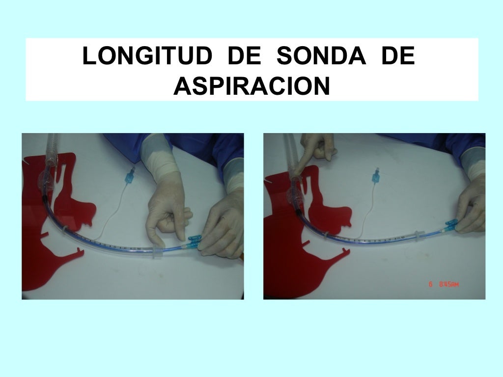 Aspiracion Secreciones