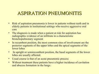 Aspiration Pneumonia | PPT