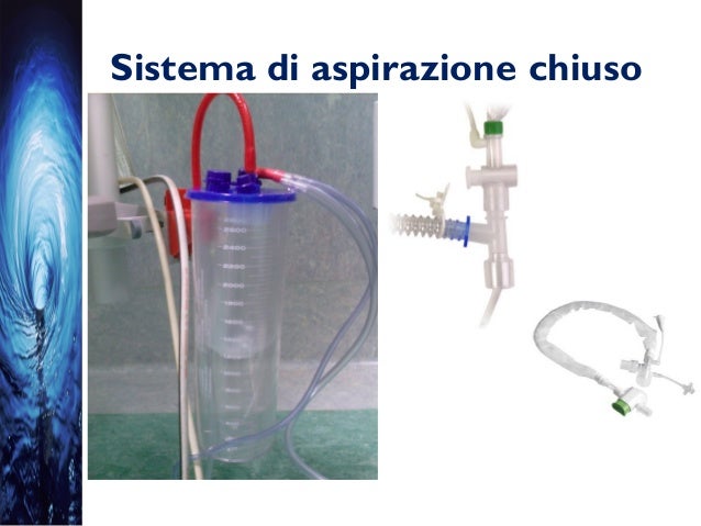 Aspirazione tracheale 2013