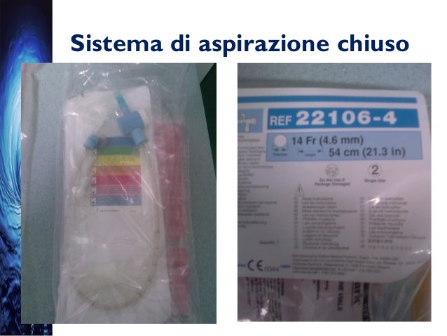 Aspirazione tracheale 2013