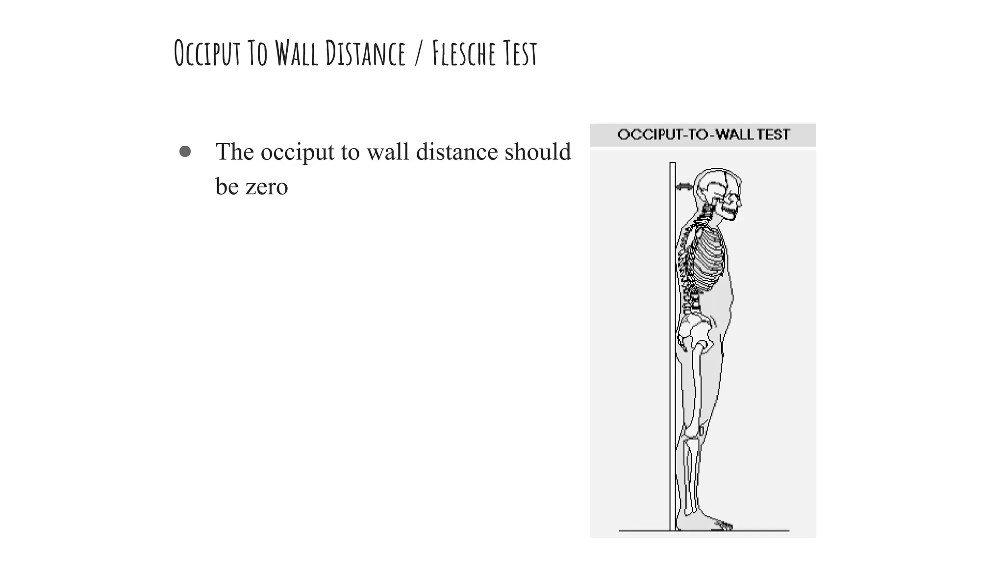ankylosing spondylitis physiotherapy management | PPTX