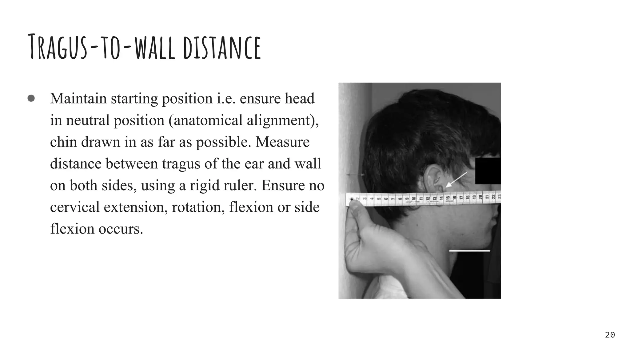 ankylosing spondylitis physiotherapy management | PPTX