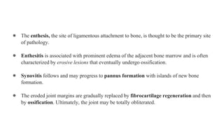 ankylosing spondylitis physiotherapy management | PPTX