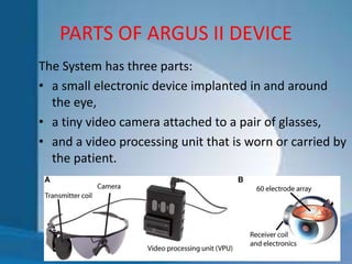 Artificial Eye For The Blind | PPTX