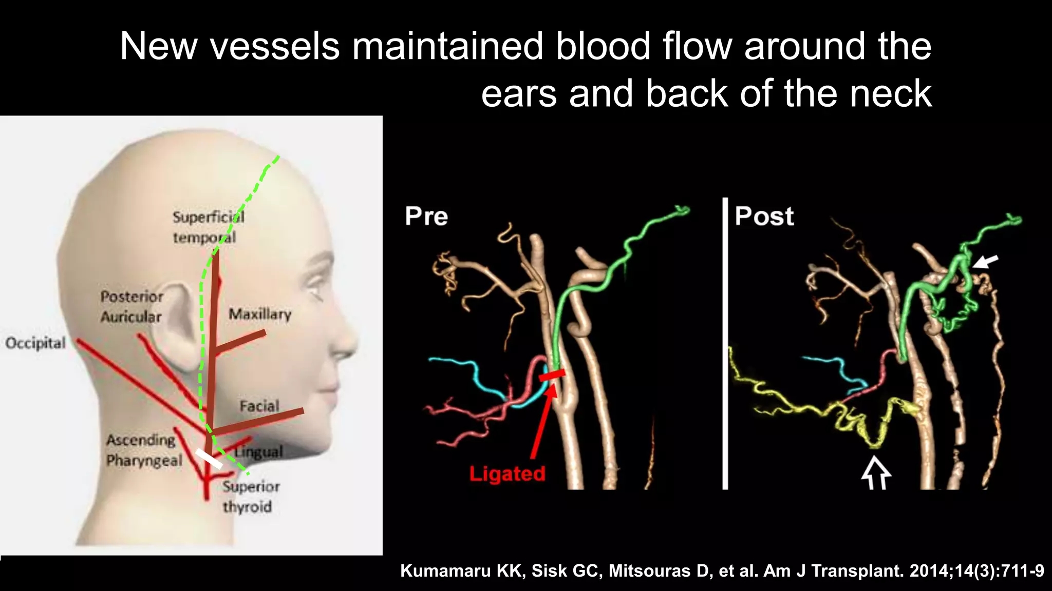 ASRT at 2015 RSNA Annual Meeting CT scanning Face Transplant Surgical ...