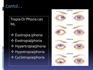 Assesssment of strabismus | PPT