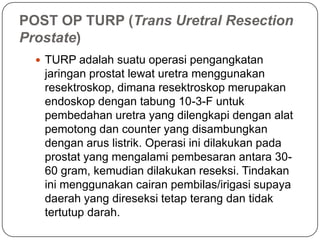 Post Op TURP | PPTX