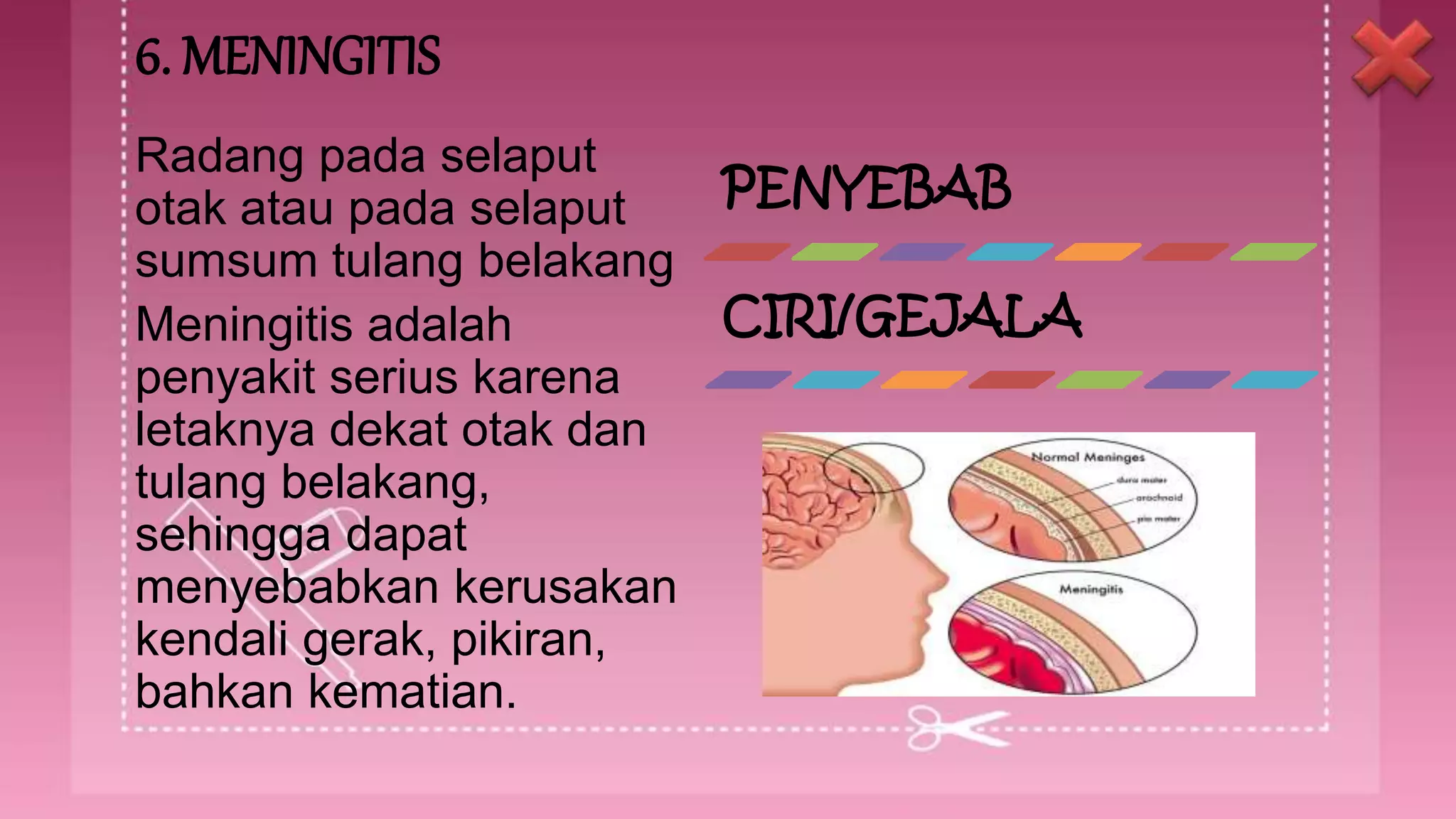 IPA BIOLOGI "PENYAKIT PADA SISTEM SYARAF" | PPTX