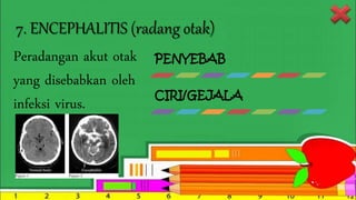IPA BIOLOGI "PENYAKIT PADA SISTEM SYARAF" | PPT