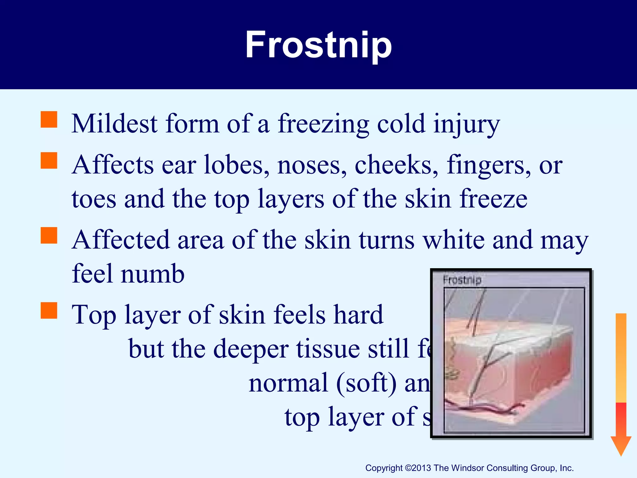 Cold Stress Hazards and Prevention | PPT