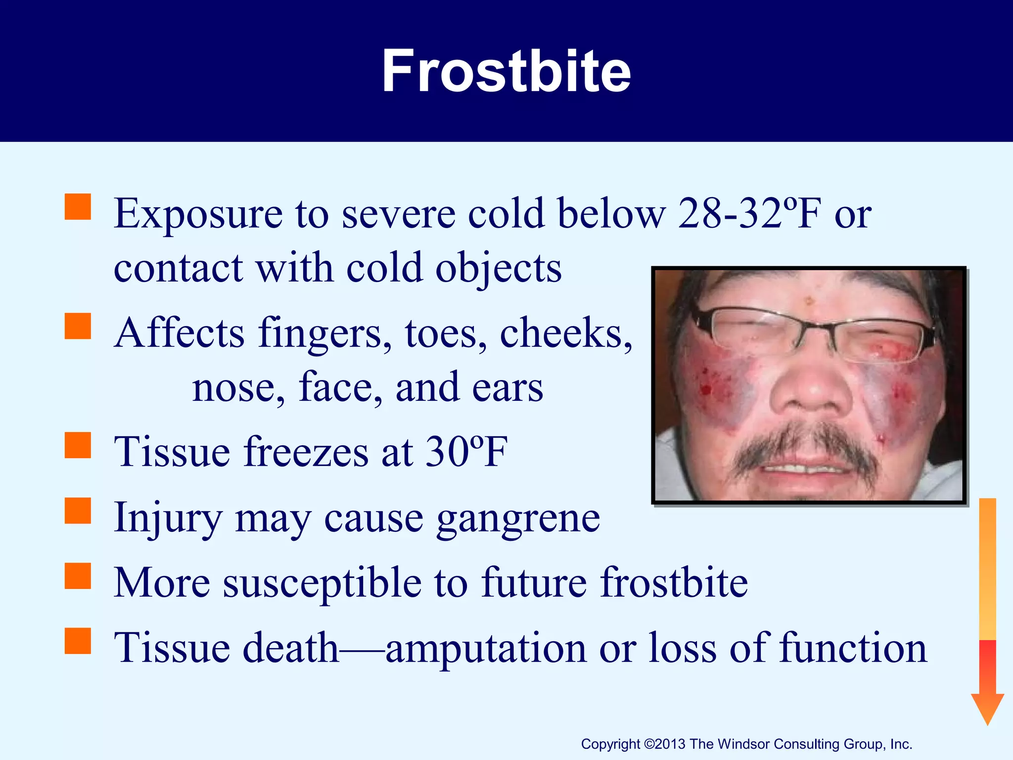 Cold Stress Hazards and Prevention | PPT